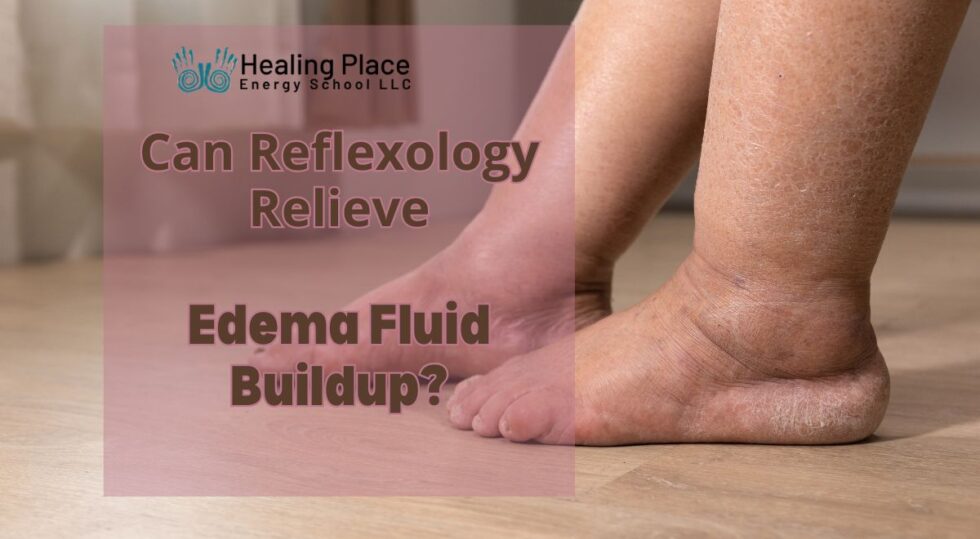 Can Reflexology Relieve #Edema Fluid Buildup? #kidneystones #painrelief ...